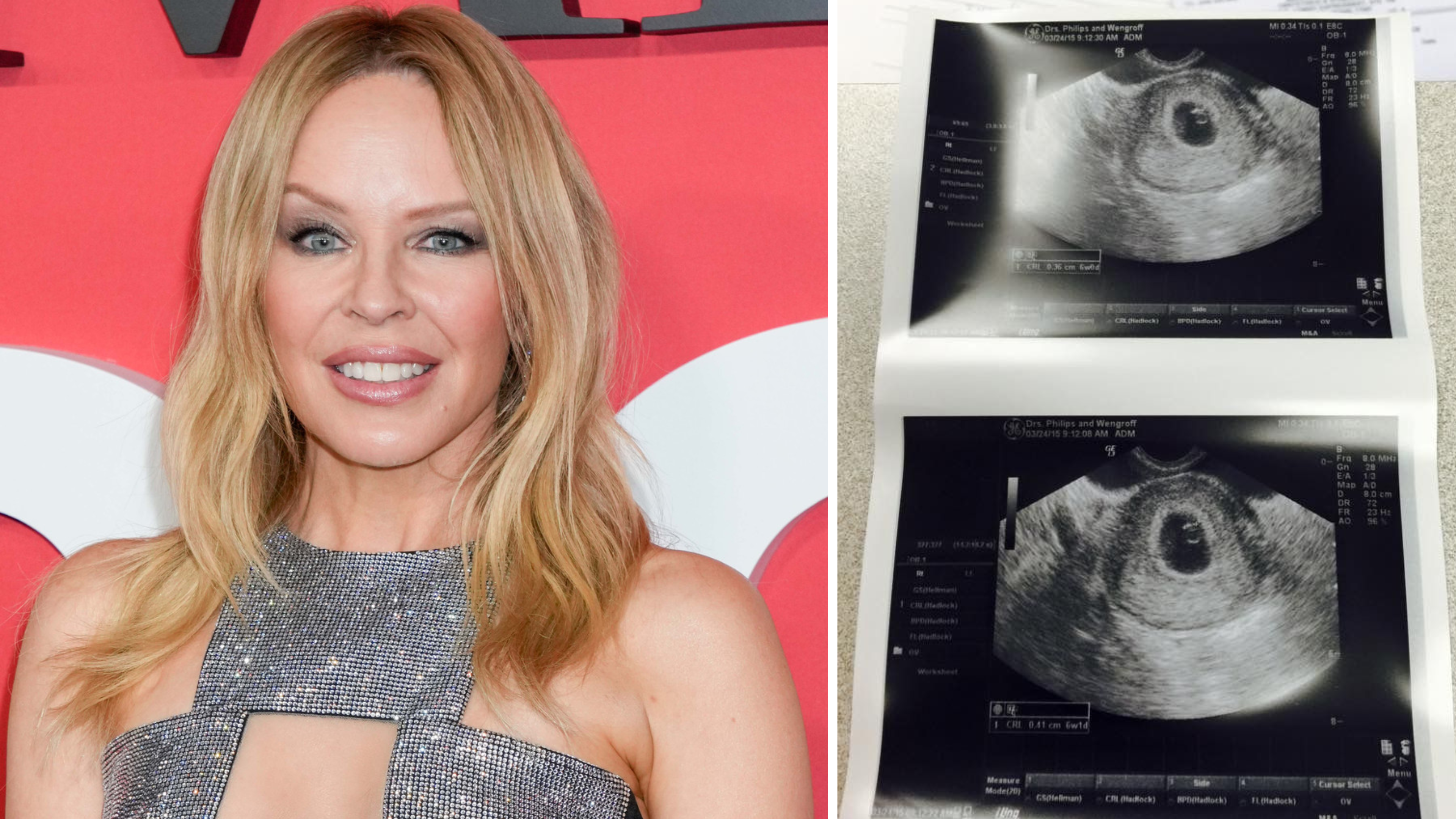 Neighbours’ Kylie Minogue Stuns Fans with Pregnancy Announcement at 56 ...
