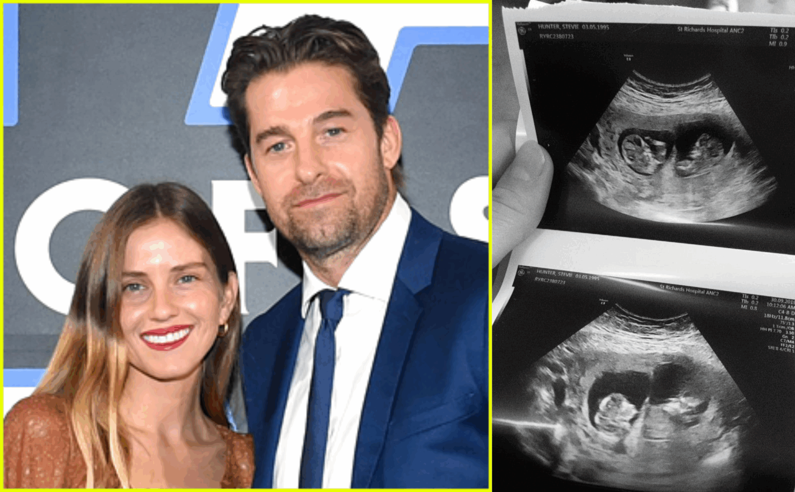 BREAKING: “Shortland Street” Scott Smart Stuns Fans with Shocking ...