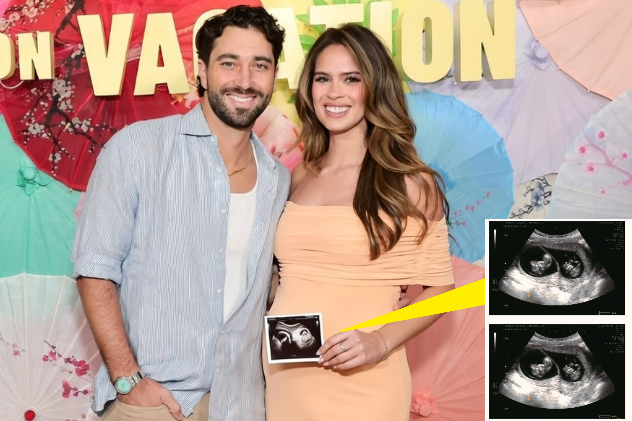 HOTT!!! Joey Graziadei and Kelsey Anderson are preparing to welcome two ...